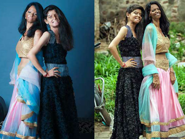 After fashion shoot, documentary on acid attack survivors - Oneindia News