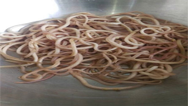 Baby vomits parasitic worm, size of that an index finger after drinking ...