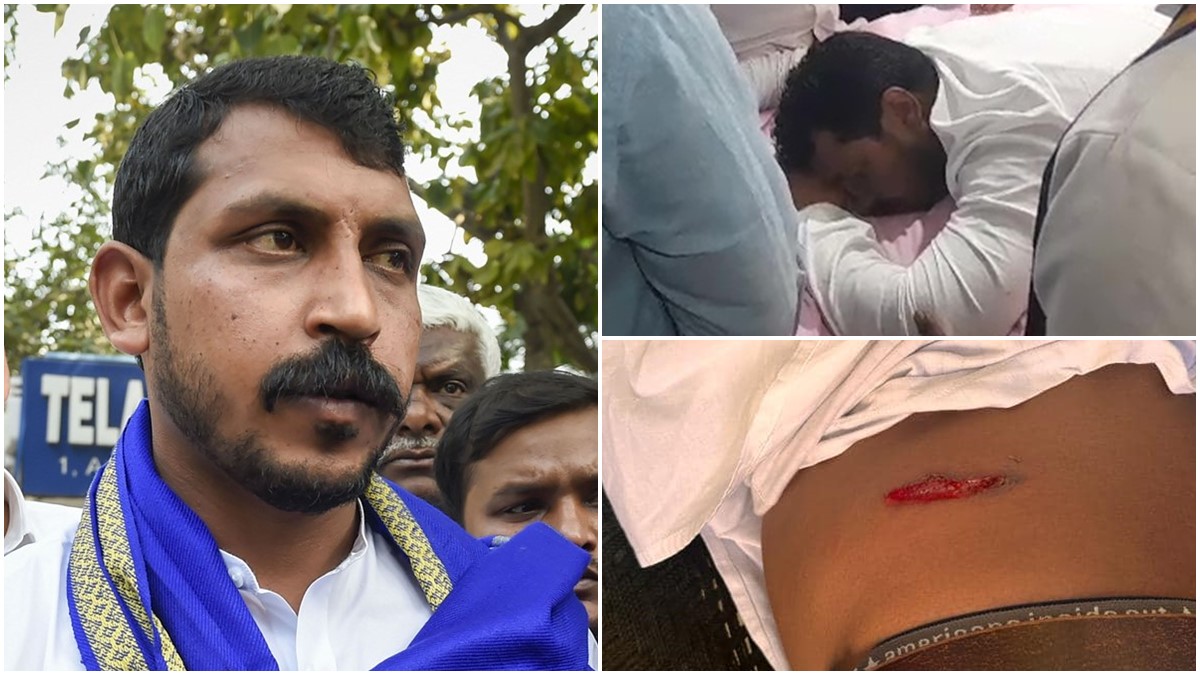 Bhim Army Chief Chandrashekhar Azad Ravan Shot At In UP's Saharanpur ...