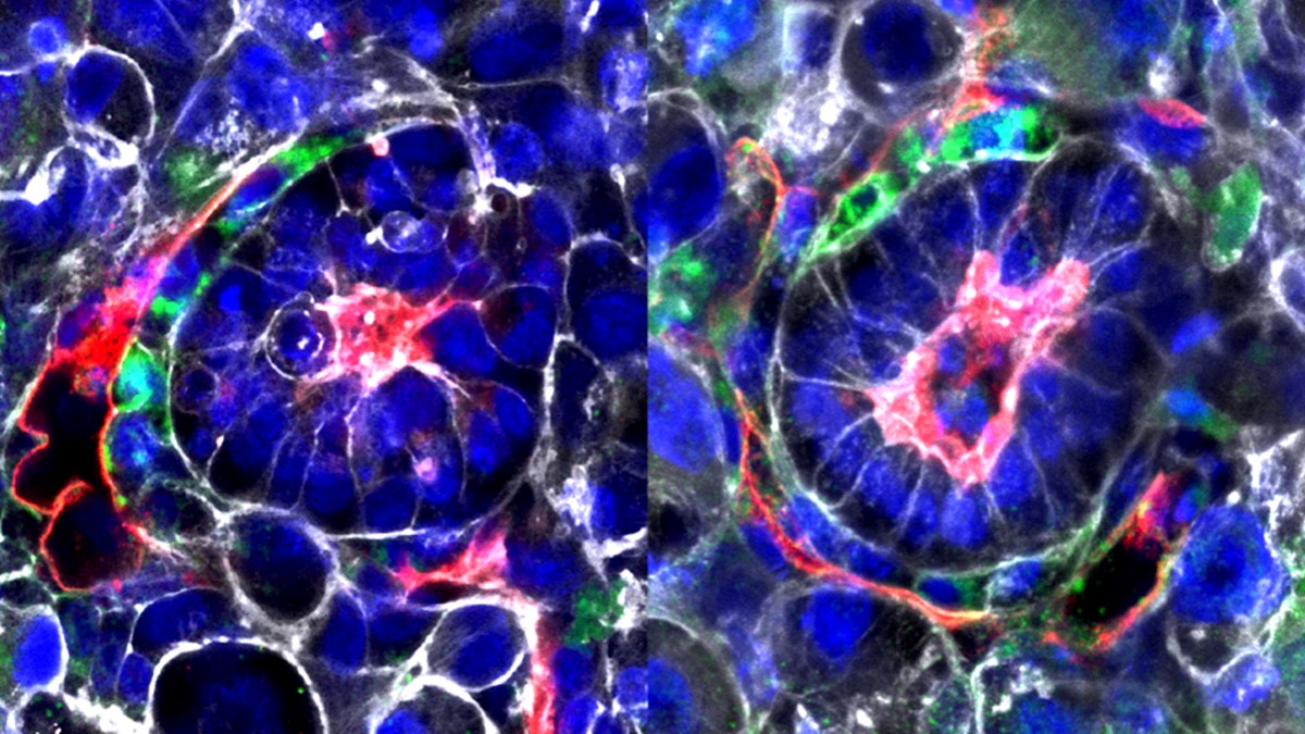 Baby Without Sperm Or Egg? Scientists Develop Synthetic Embryos Using ...