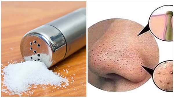 Here are some tips on how to get rid of blackheads on nose permanently ...